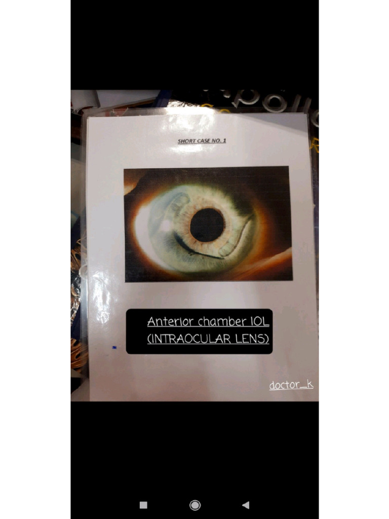 Ophtha Short Cases | PDF