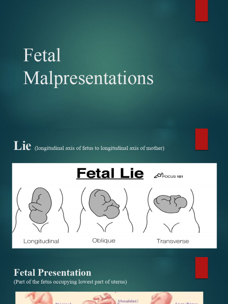 7 - Fetal Malpresentation | PDF