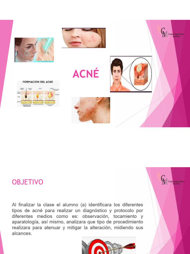 Acne | PDF | Especialidades Medicas