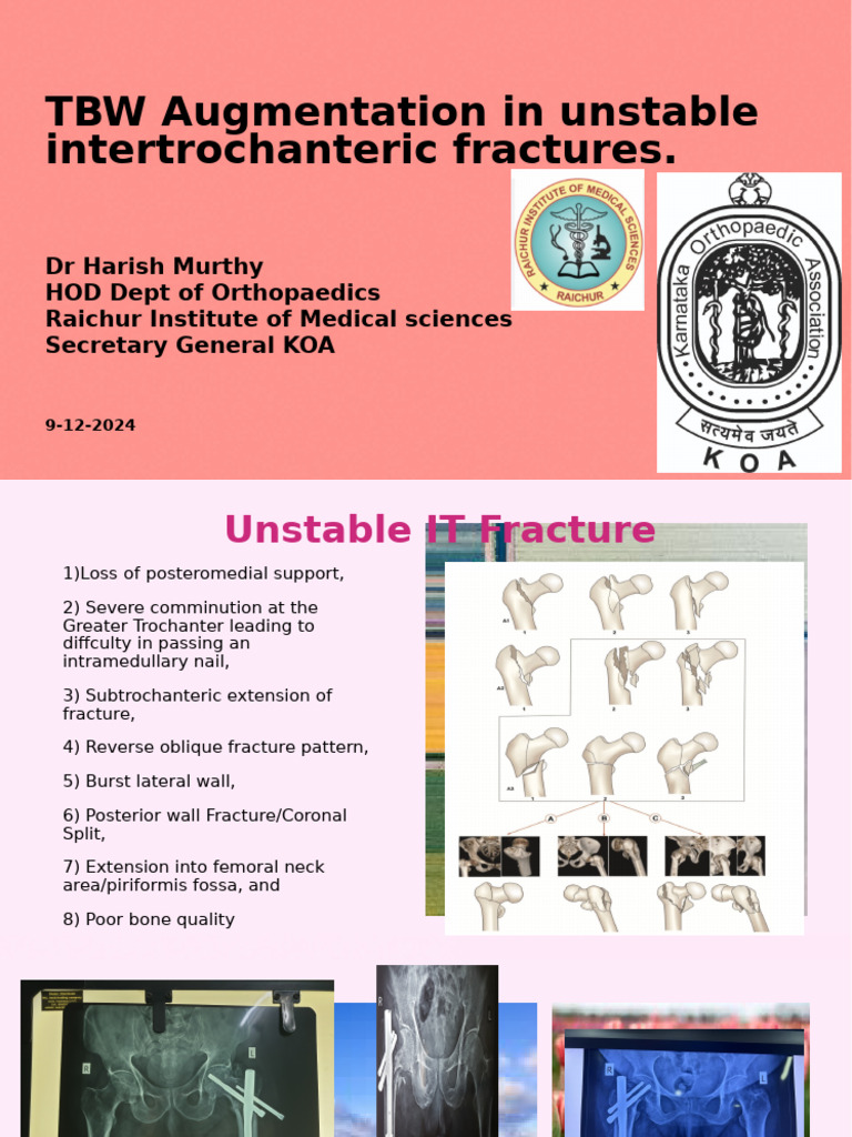 TBW in Unstable IT Fractures | PDF