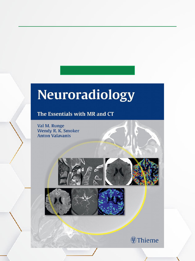 Neuroradiology The Essentials With MR and CT - 1st Edition Verified Download | PDF