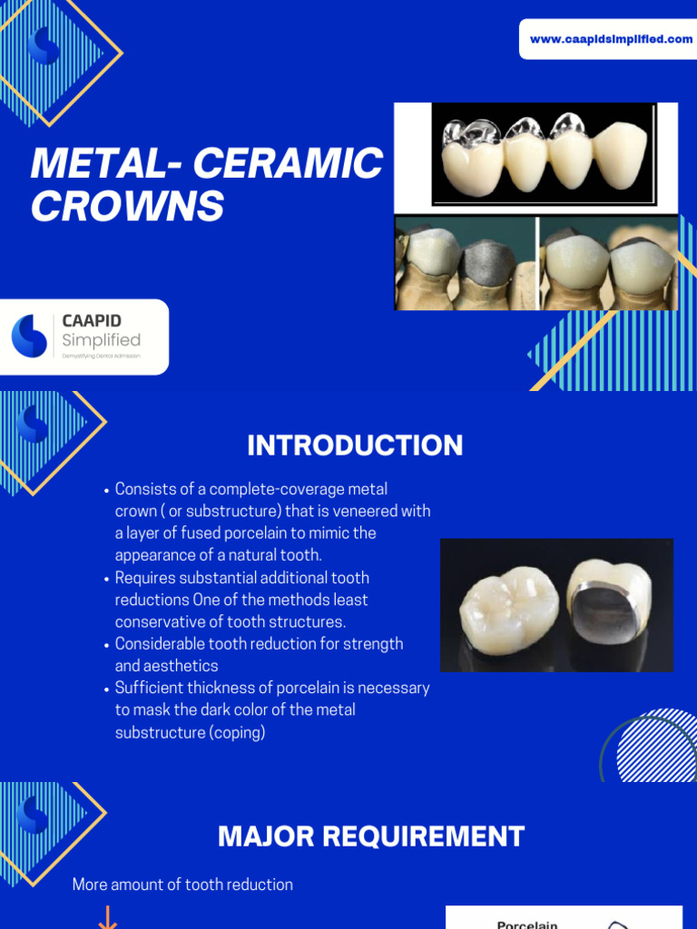 Metal-Ceramic-Crowns Preparation | PDF | Dentistry Branches | Mouth