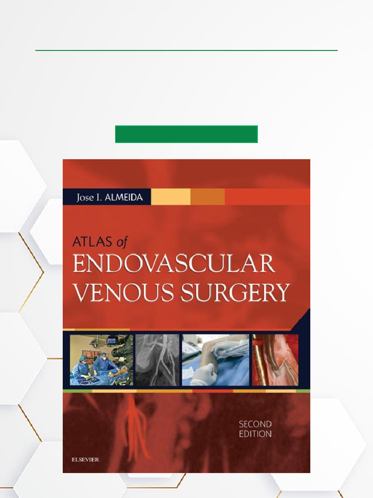 Atlas of Endovascular Venous Surgery 2nd Edition PDF DOCX Download | PDF | Vein | Varicose Veins
