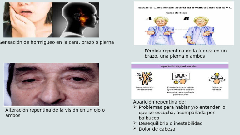 Presentación1 EVC | PDF