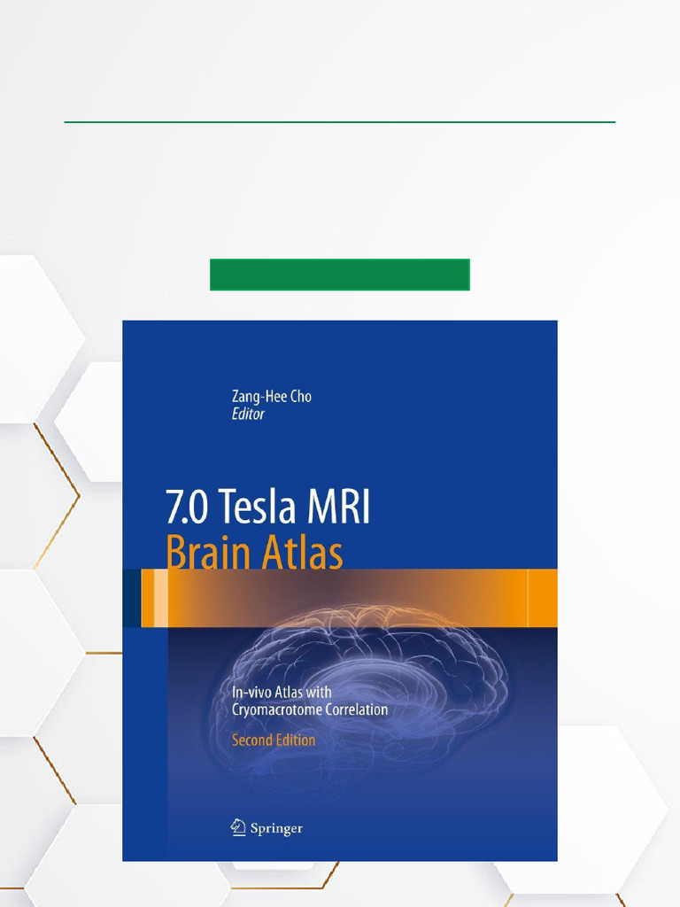 7.0 Tesla MRI Brain Atlas In Vivo Atlas with Cryomacrotome Correlation ...