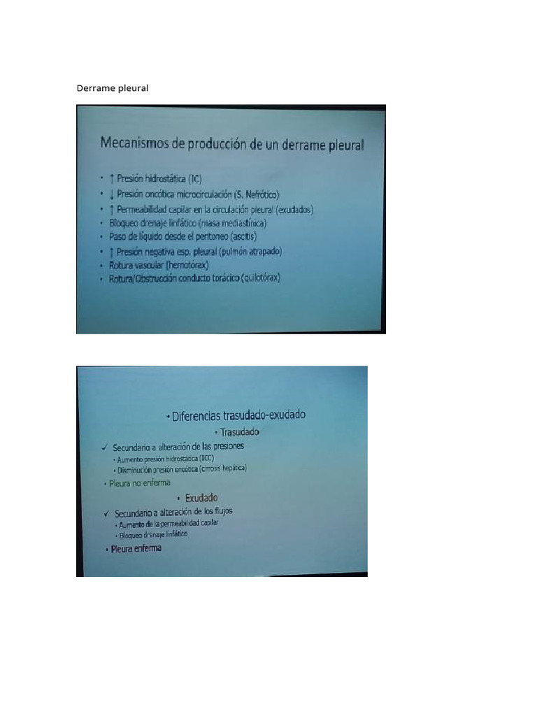Diagnóstico y tratamiento del derrame pleural | PDF | Medicina CLINICA ...