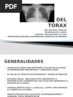 Radiografía de Tórax Normal - Patrón Intersticial | PDF | Pulmón | Tórax