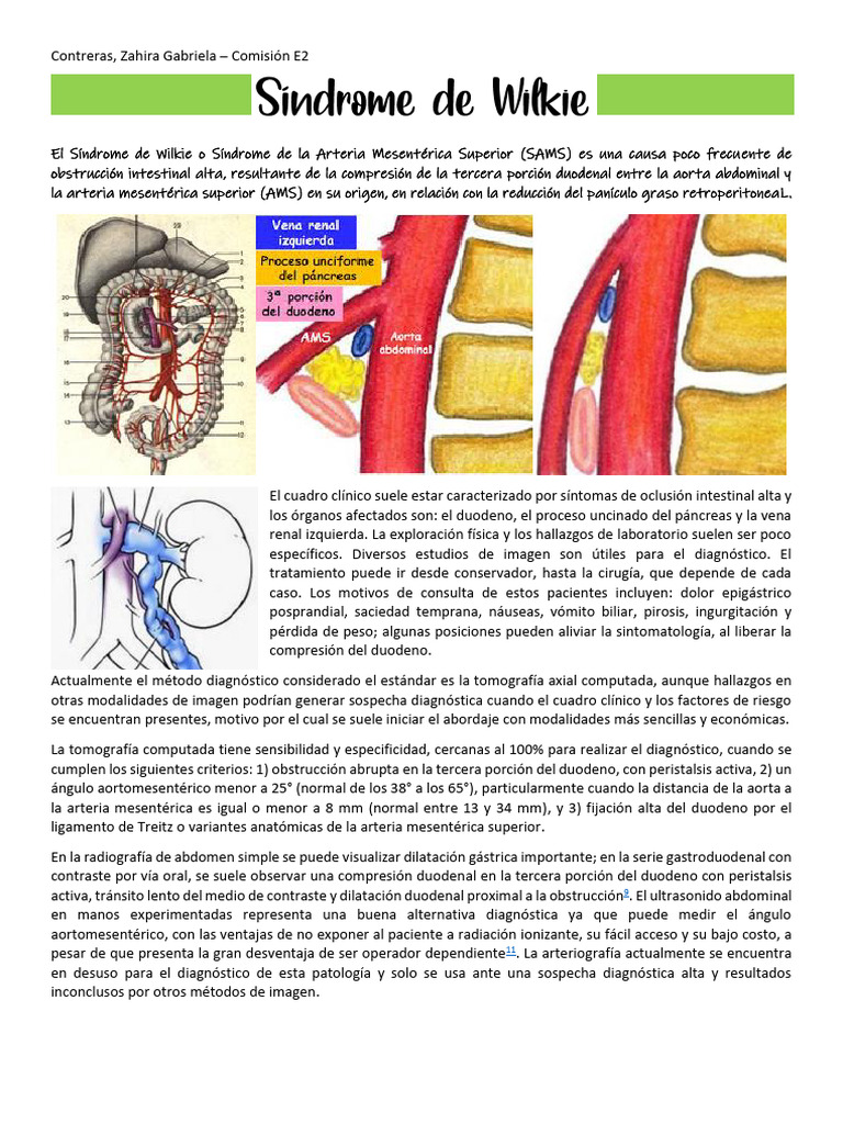 Síndrome De Wilkie Pdf Enfermedades Y Trastornos Especialidades