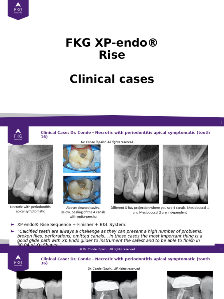 FKG - XP-endo Rise - Clinical Cases - 202402 | PDF | Dentistry Branches ...