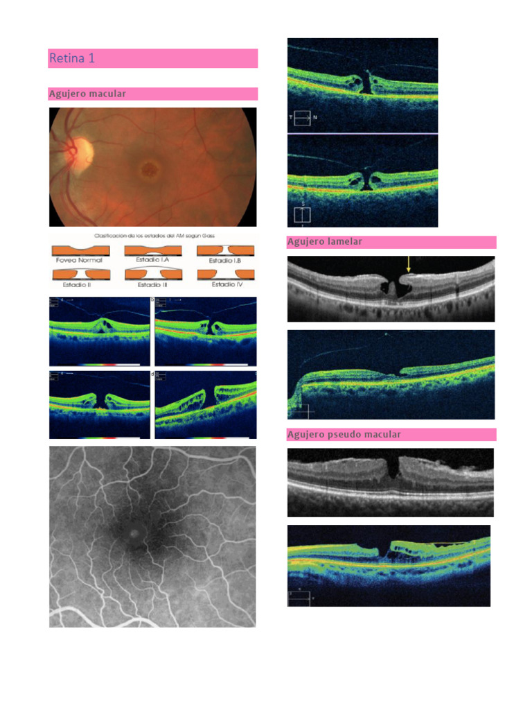 Retina Fotos | PDF