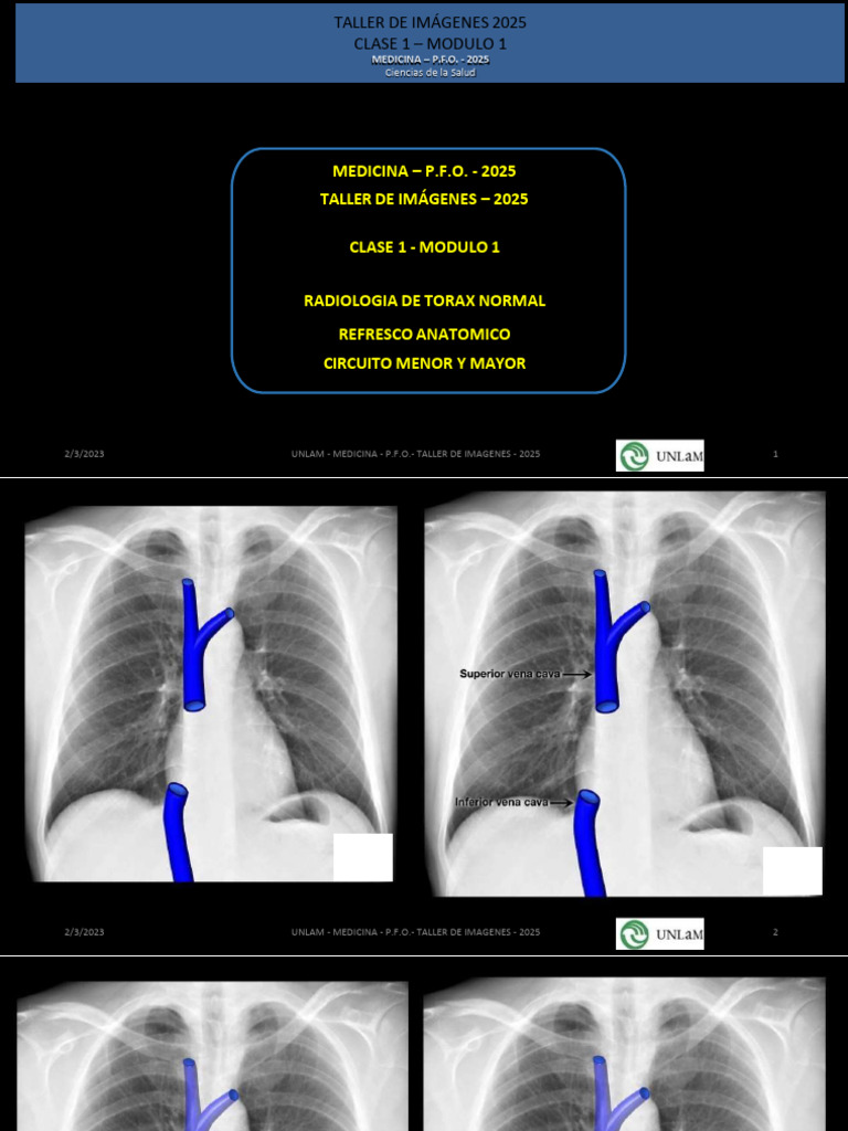 1) Anexo Imagenes - Anatomia Cardiovascular Normal | PDF