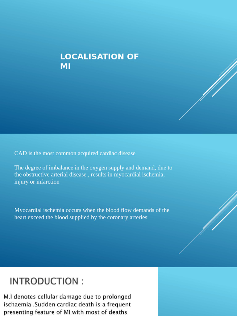 Localization of MI | PDF