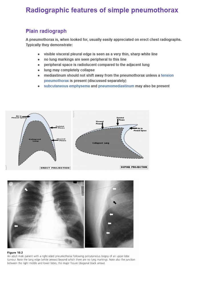 Pleura Space | PDF | Diseases And Disorders | Respiratory System