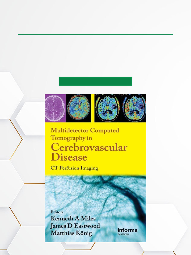 Multidetector Computed Tomography in Cerebrovascular Disease CT ...