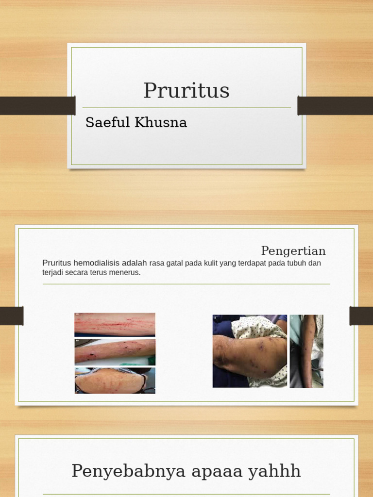 PPT Pruritus (2) | PDF