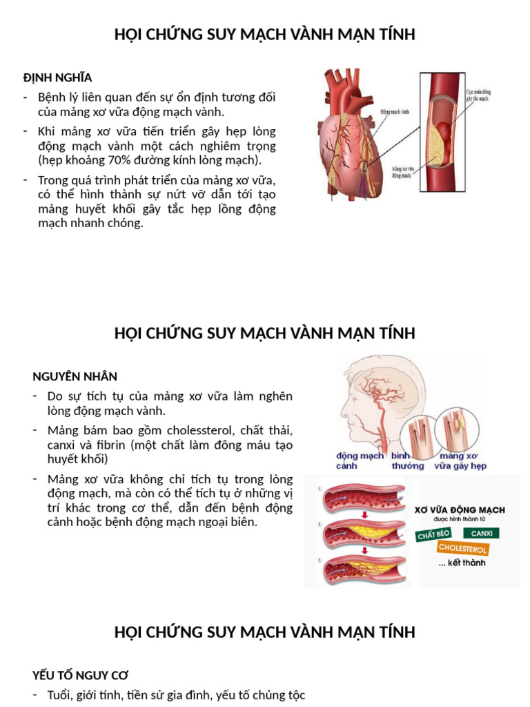 H I CH NG Suy M CH Vành M N Tính | PDF