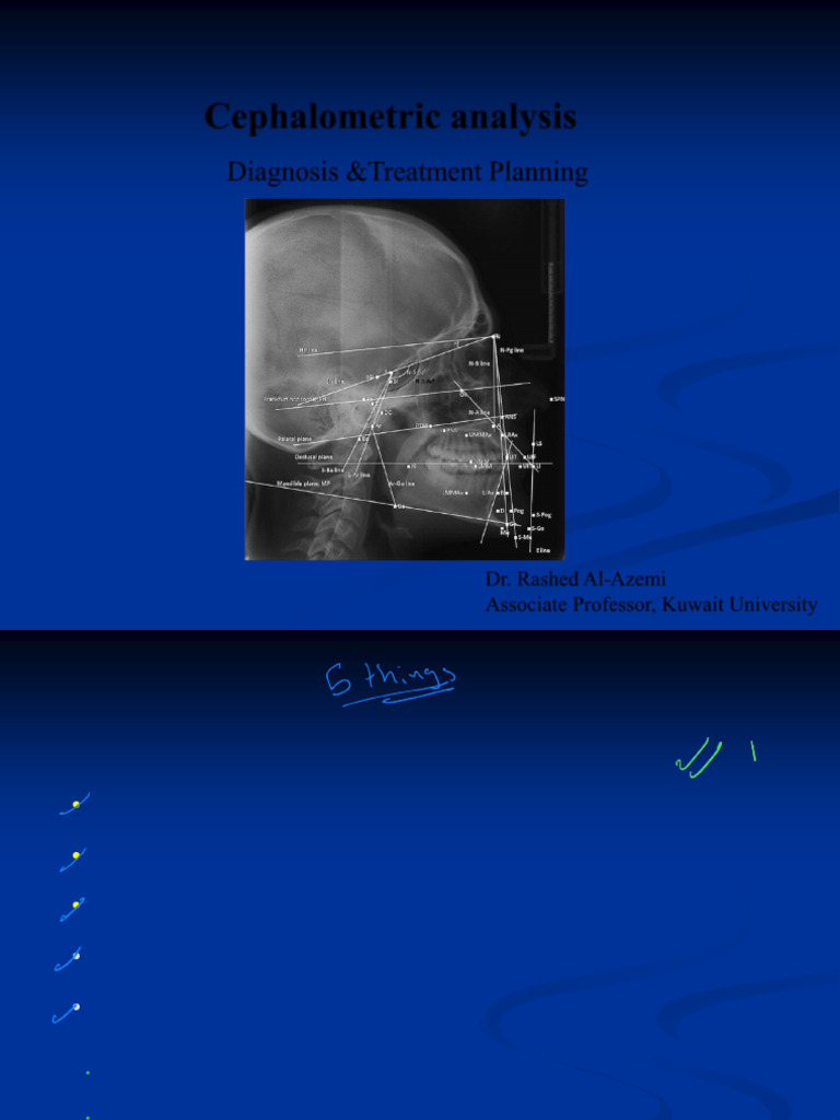 Cephalometric - PPT For MGDS | PDF