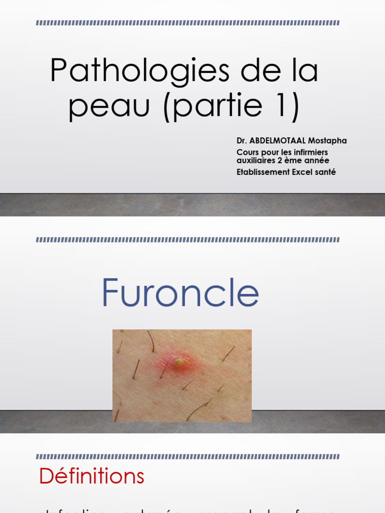 Furoncles et anthrax cutané : Guide clinique | PDF | Anthrax | Médecine ...