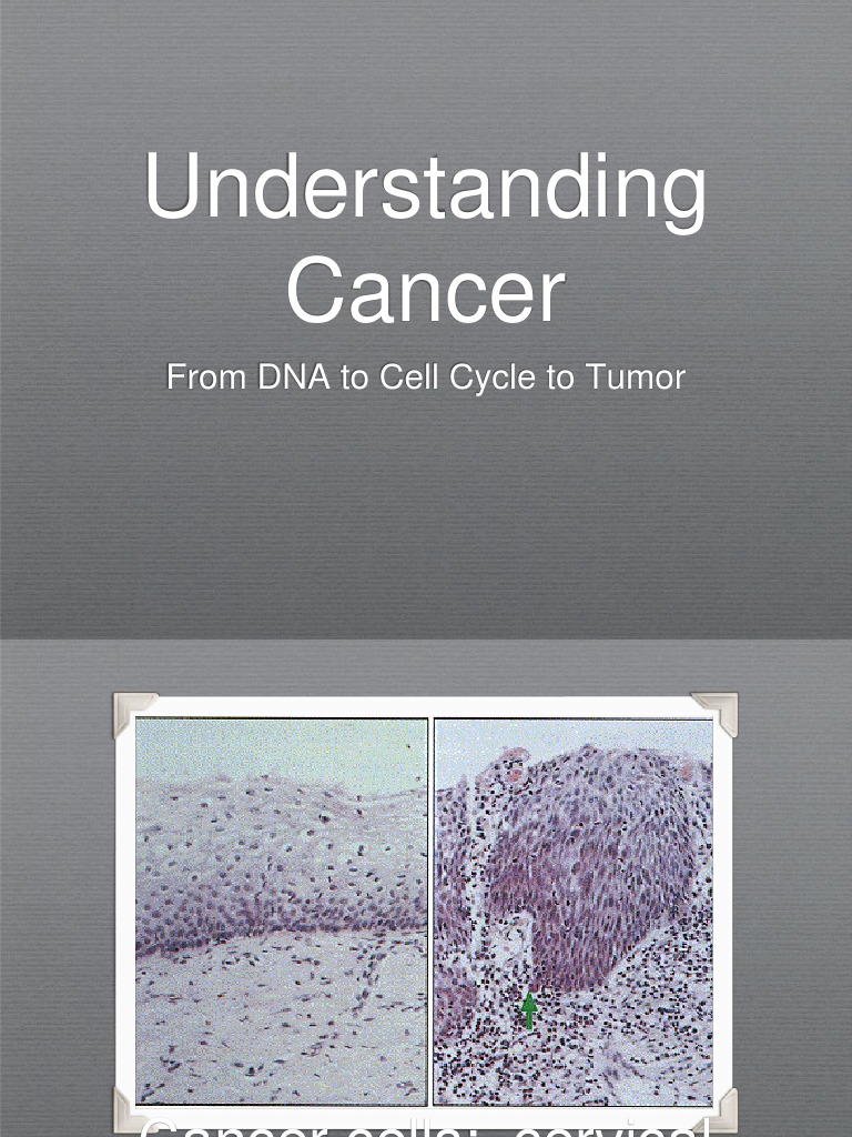 Understanding Cancer: From DNA To Cell Cycle To Tumor | PDF | Mutation ...