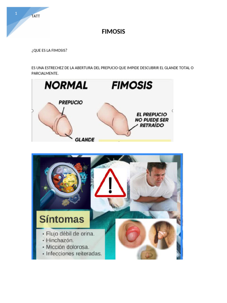FIMOSIS | PDF