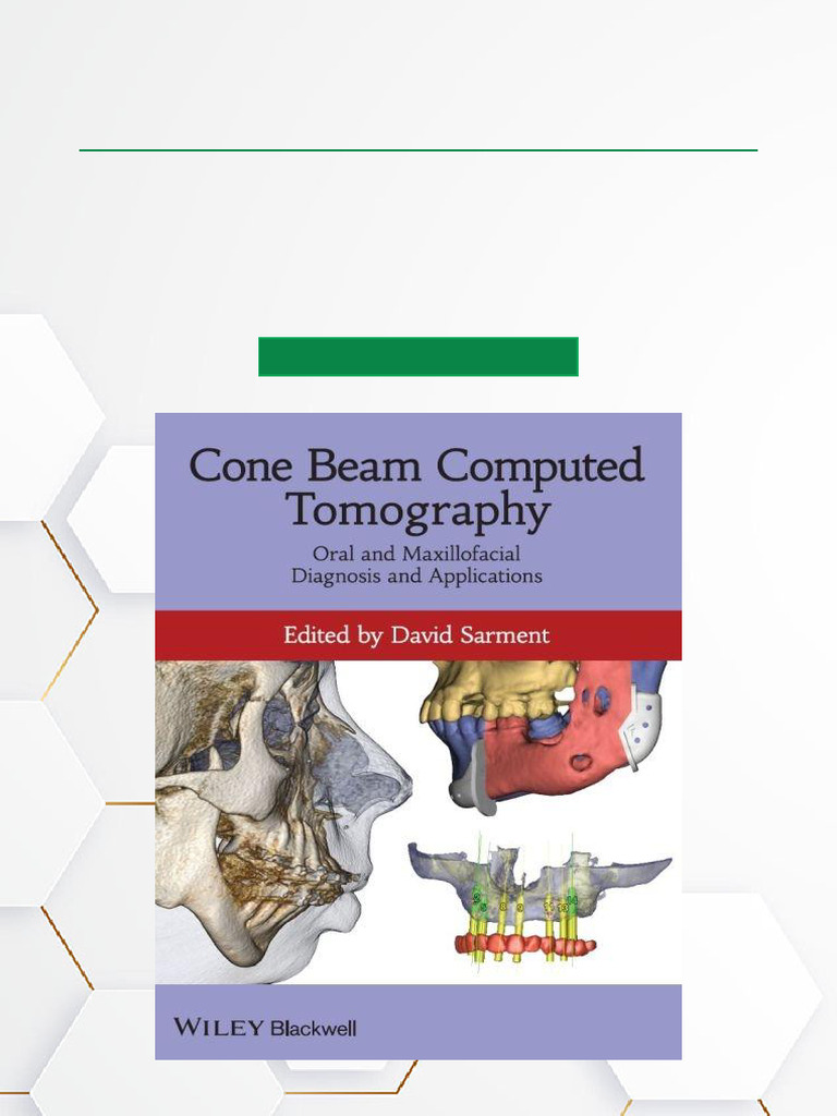 Cone Beam Computed Tomography Oral and Maxillofacial Diagnosis and ...