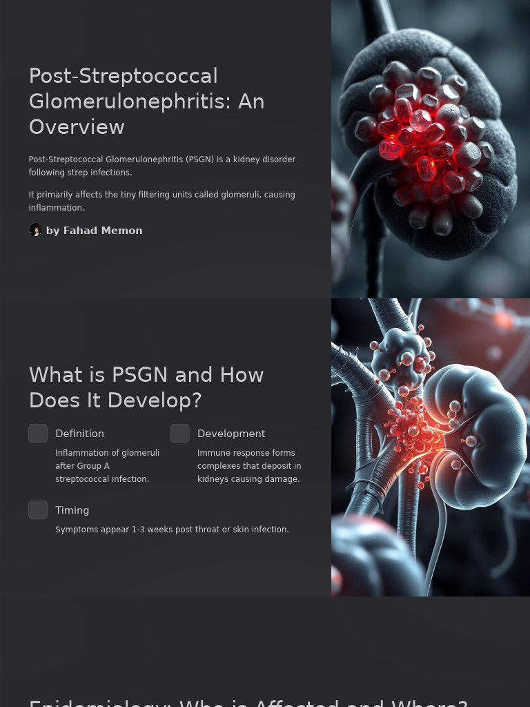 Post Streptococcal Glomerulonephritis An Overview | PDF | Kidney ...