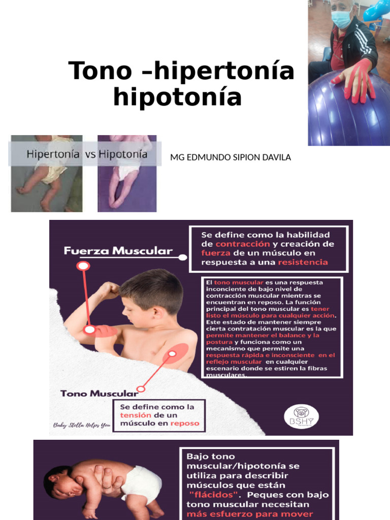 Tono - Hipertonia | PDF