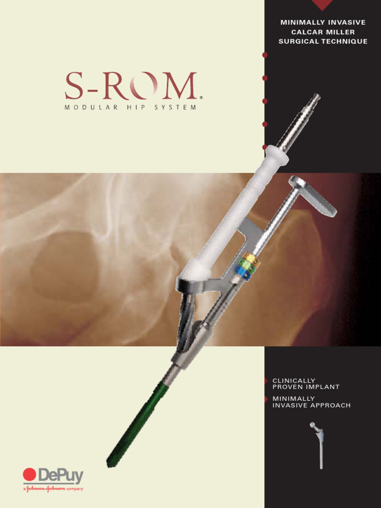 S-ROM Modular Hip System Technique Guide | PDF | Hip | Musculoskeletal ...