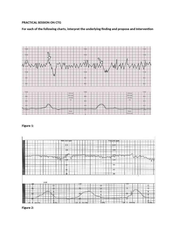 Practical Session On CTG | PDF