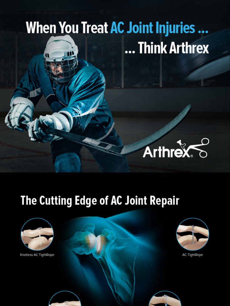 AC Joint Repair Arthrex | PDF | Surgical Suture | Joints