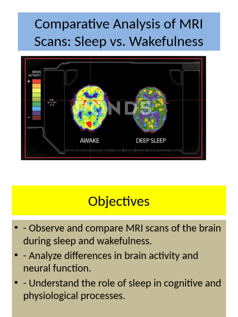 MRI Sleep vs Wakefulness | PDF