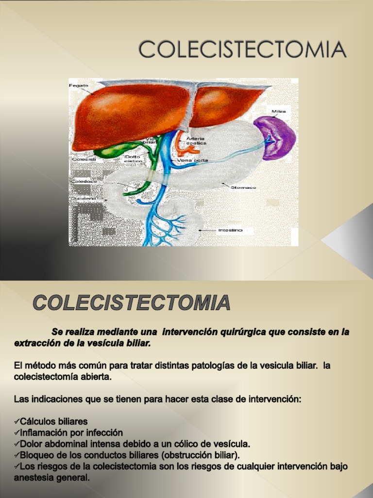 COLECISTECTOMIA