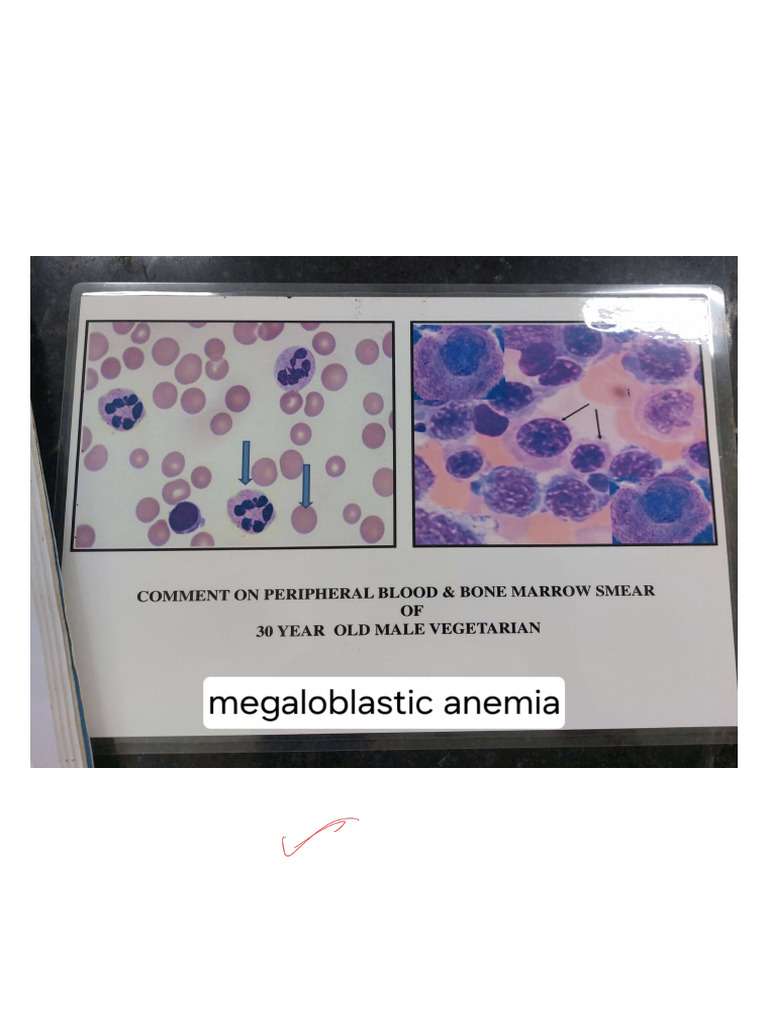 SPOTTING, CHARTS Patho - 240902 - 141857 | PDF