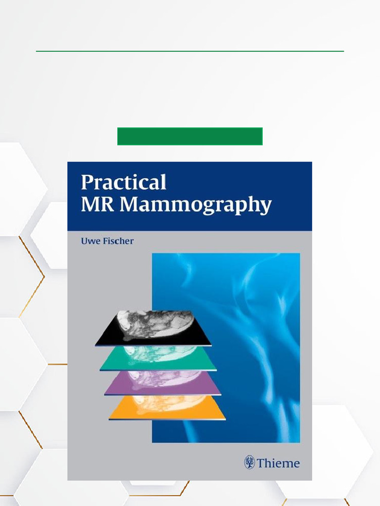 Practical MR Mammography, 1st Edition ISBN 3131606215, 9783131606211 ...