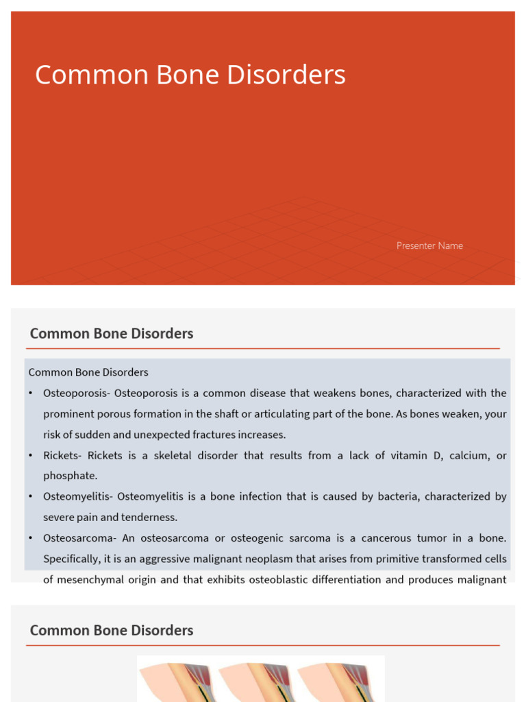 Overview of Common Bone Disorders | PDF
