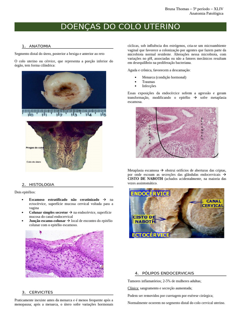 02 - Doenças Do Colo Uterino | PDF | Câncer cervical | Câncer
