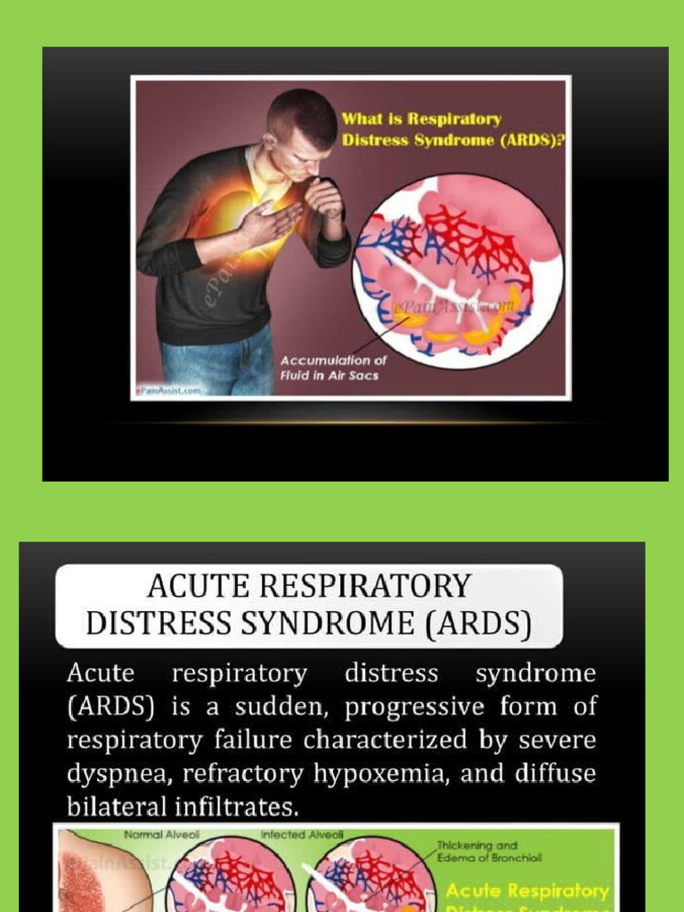Acute Respiratory Distress | PDF