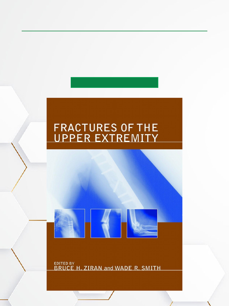 Fractures of The Upper Extremity 1st Edition ISBN 0824747186 ...