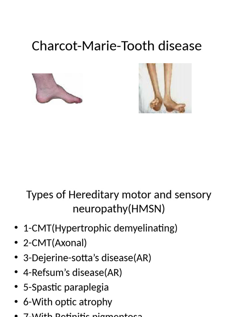 Charcot-Marie-Tooth Disease Overview | PDF