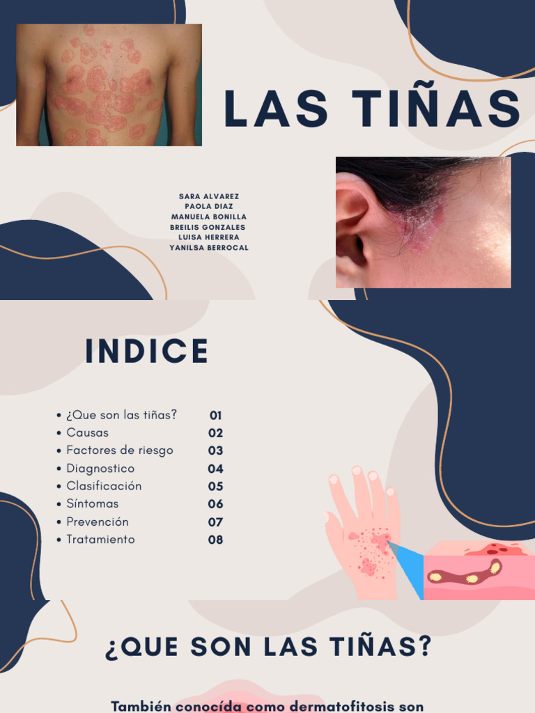 2 Tiña. | PDF | Microbiología | Enfermedades y trastornos humanos