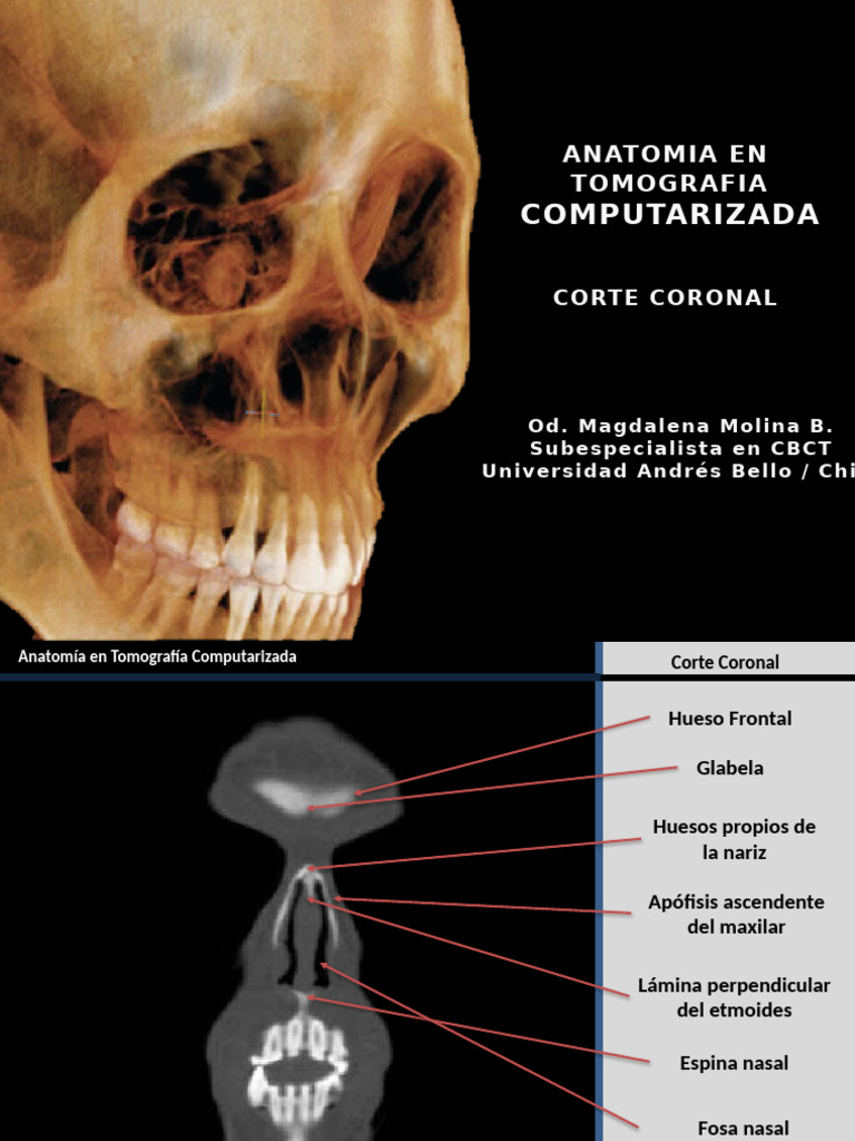 Anatomia Normal CBCT | PDF | Nariz humana | Cabeza y cuello humanos