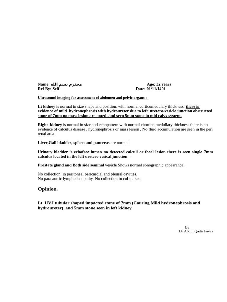 UVJ Stone Cause Hydro RT Kdi ST | PDF