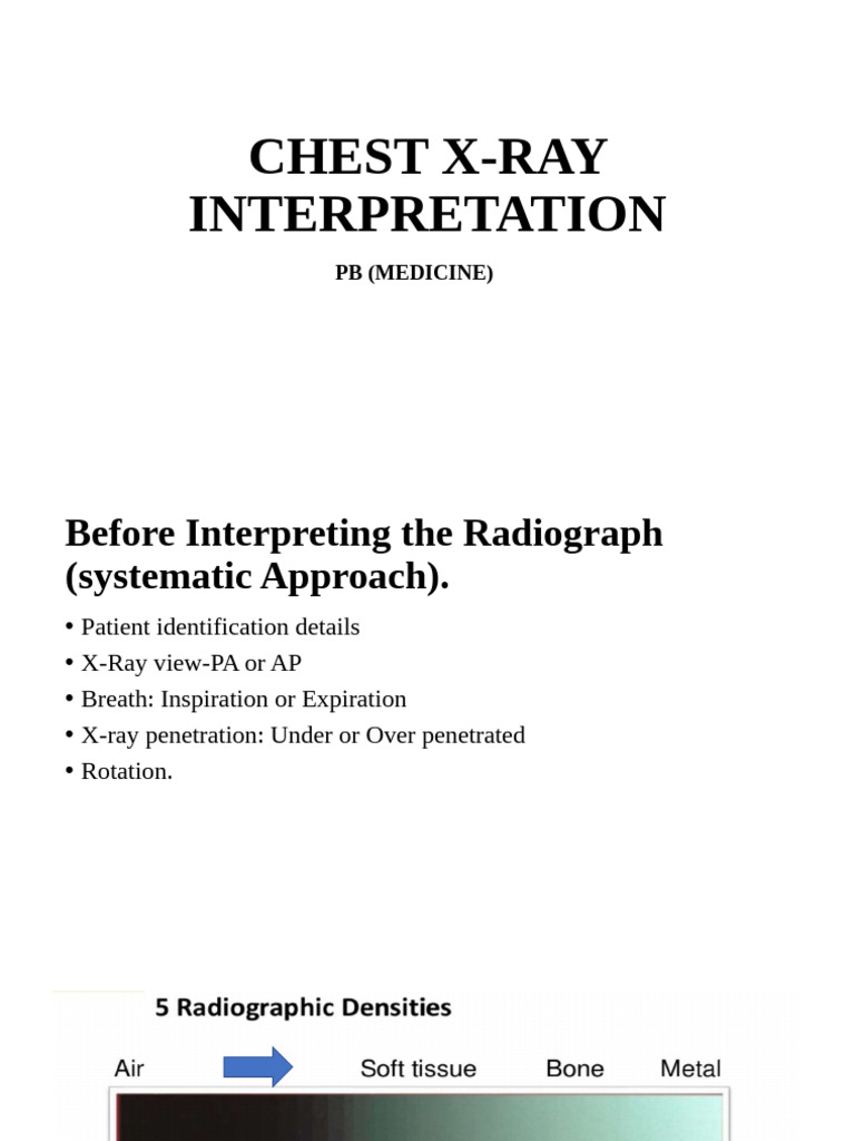 Chest X-Ray Interpretation | PDF