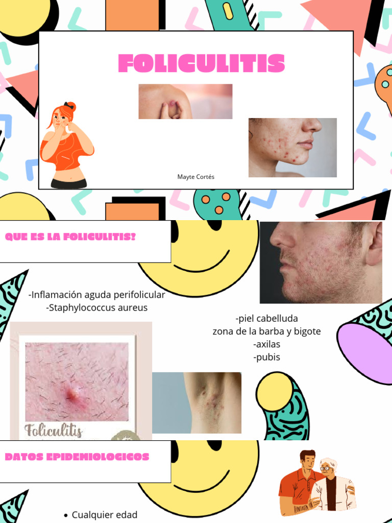 Causas y Tratamiento de Foliculitis | PDF | Perdida de cabello ...