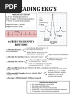 ECG - EKG Practice Quiz (Identify Rhythms) | PDF | Electrocardiography ...