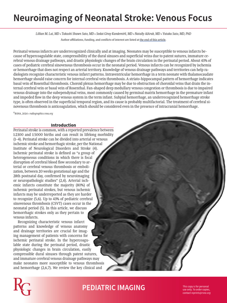 Neuroimaging of Neonatal Stroke Venous F | PDF | Vein | Thrombosis