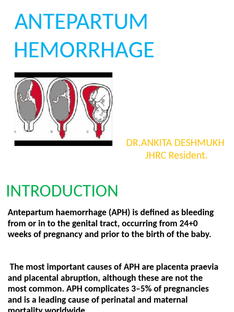 Understanding Antepartum Hemorrhage | PDF