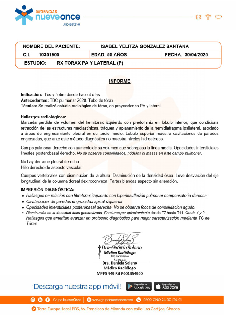 Isabel Yelitza Gonzalez Santana RX Torax | PDF