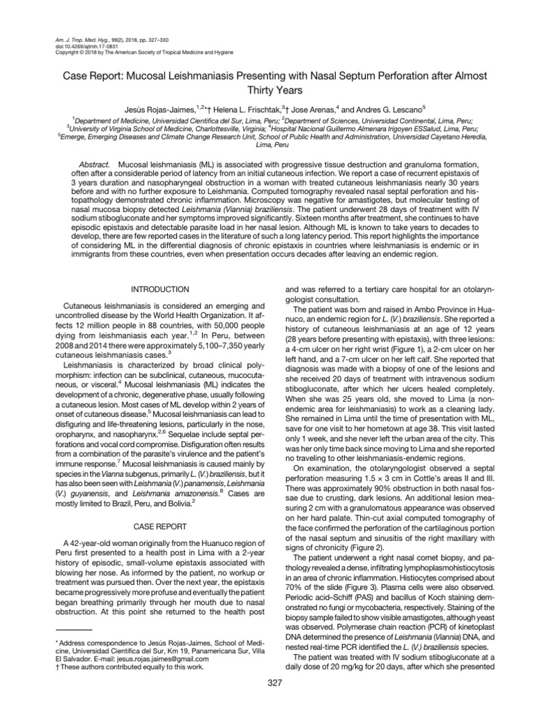 Case Report Mucosal Leishmaniasis Presenting With Nasal Septum ...