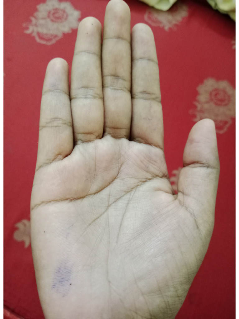 Hand | PDF